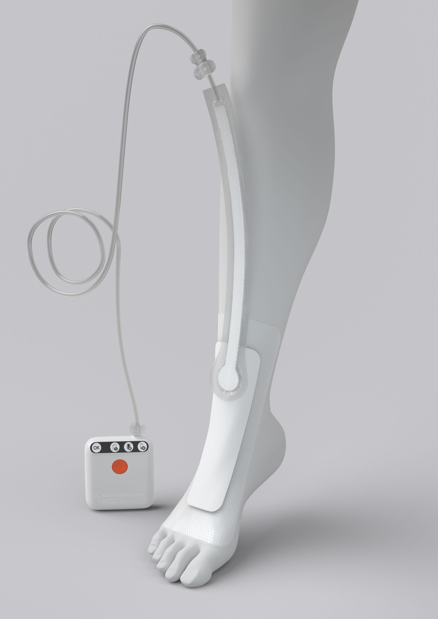 PICO 14 - Prevención Úlceras y Heridas tret e